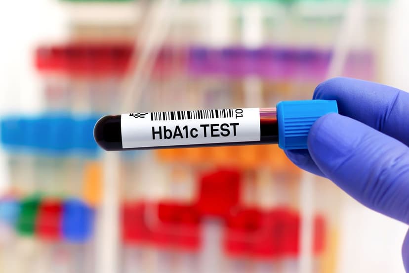 What is HbA1c, and why does it matter? | Levels | Levels