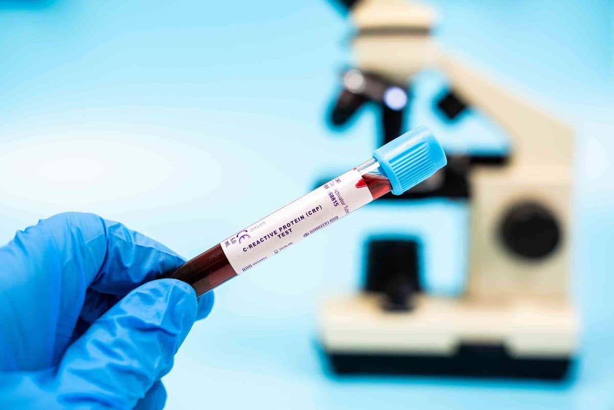How to interpret blood tests for inflammation | Levels | Levels