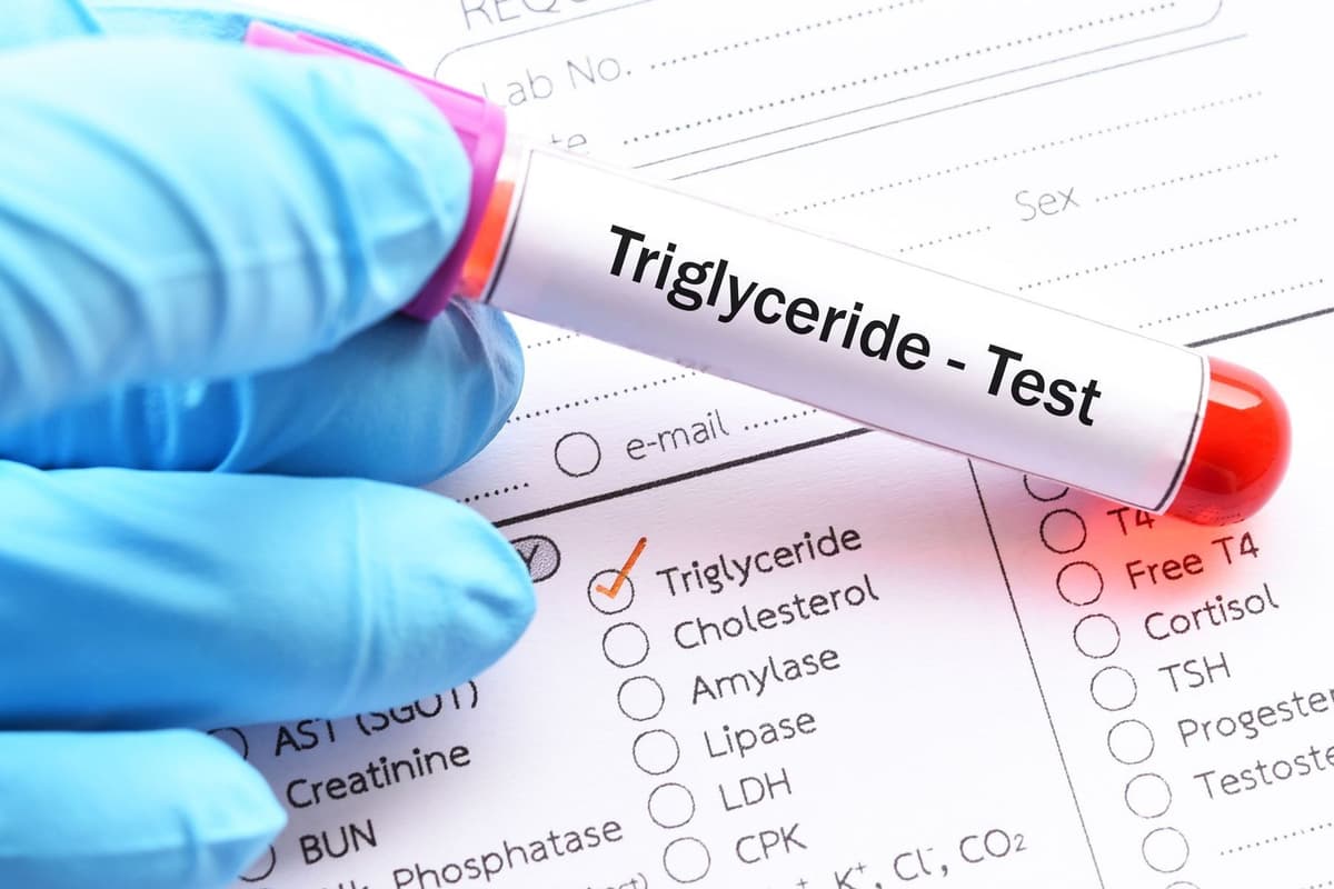 The 2026 Levels Guide to triglycerides | Levels | Levels