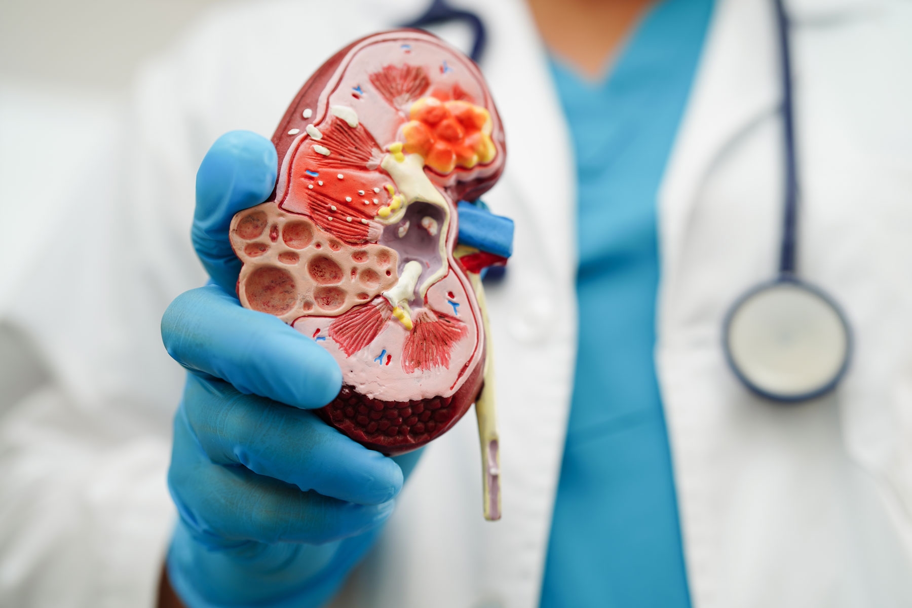 6 Things you need to know about kidney health | Levels | Levels